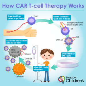 CAR T-Cell Therapy | Norton Children's Louisville, Ky.